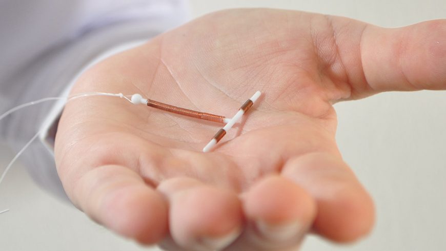 Nuevo anticonceptivo con menos hormonas: Diu KYLEENA